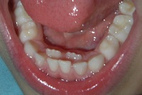 Cabinet Dentiste Dr Catherine Ronchini - Carbonne